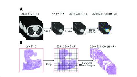 Image Preprocessing A Ct Image Preprocessing Of Spsn B Wsis