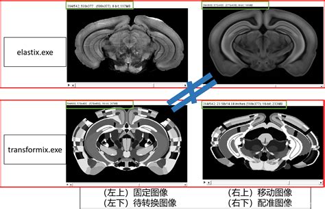 （1）elastix图像配准：算法原理 环境配置 使用教程（详解） csdn博客