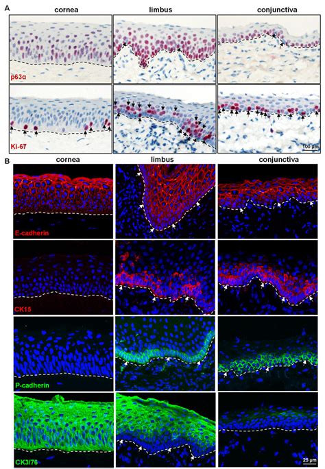 Negative Corneal Staining
