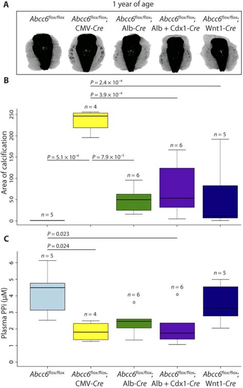 Ectopic Calcification In Pseudoxanthoma Elasticum Responds To Inhibition Of Tissue Nonspecific