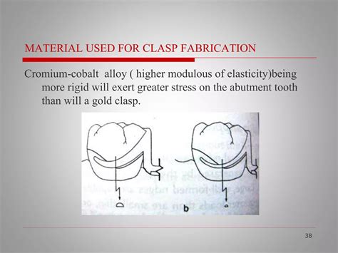 Designing For Kennedy Class I And Class Ii Ppt Oral Care Personal Care