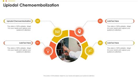 Lipiodol Chemoembolization Ppt Powerpoint Ppt Presentation
