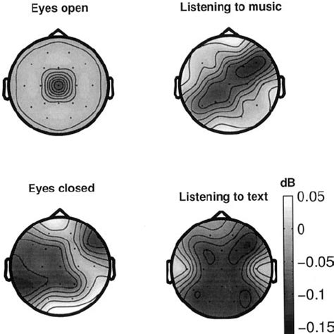 Scalp Topographies Of The Band Spectral Power Differences Expressed Download Scientific