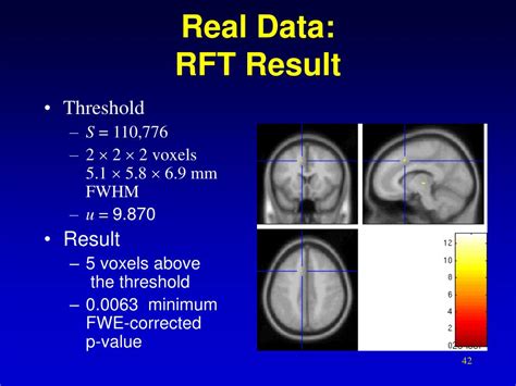 Ppt Parametric Thresholding Methods Random Field Theory And False