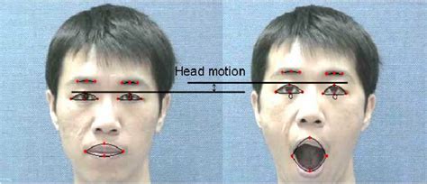 1 The Result Improved Of The Head Motion Download Scientific Diagram