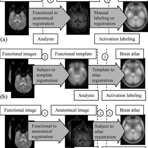 Various Functional Localization Procedures A Single Subject Analysis
