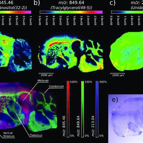 Sagittal Section Of A Mouse Brain Acquired With The Optimized Sputtered Download Scientific