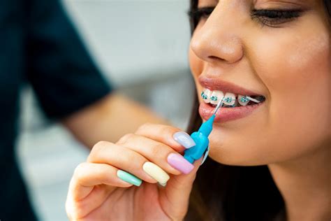 Interdental Brushes Vs Flossing Understanding The Differences And