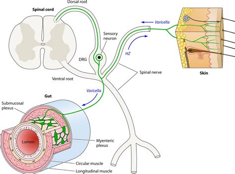 Shingles Mind Map
