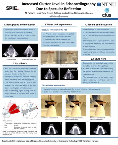 pdf increased clutter level in echocardiography due to specular