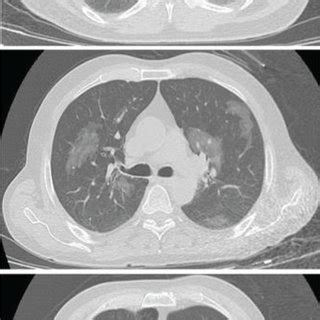 A Demonstration Of Employing Z Score Normalization Approach A