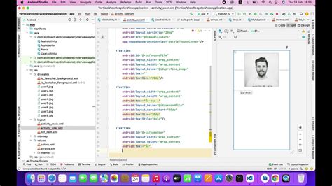 Ep6 เชื่อมโยงหน้าใหม่ด้วย Item Click Listenner Recyclerview ภาษา