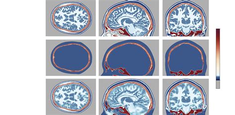 Devitopro Getting Hip With Amd Instinct™ Devito Codes