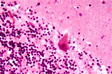 Human Cerebellar Cortex Photomicrograph Showing Purkinje Cells Granular Cells And Molecular