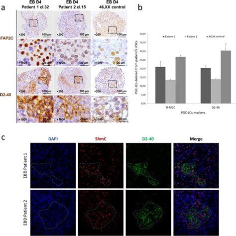 Immunohistochemical Ihc Expression Of Tfap2c And D2 40 On Ebs Download Scientific Diagram