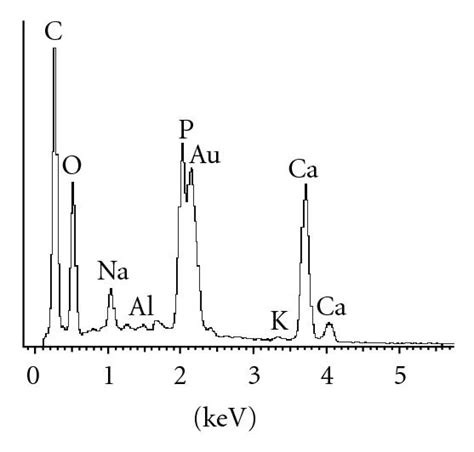Matrix Mineralization By Human Bone Marrow Osteoblast Cell Cultures