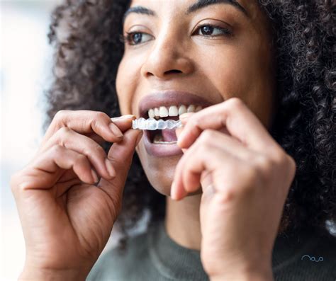 How To Clean Your Invisalign Aligners Nova Smiles