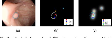 Figure From Comparative Validation Of Polyp Detection Methods In Video Colonoscopy Results