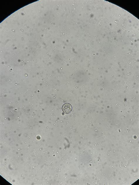 Could This Be A Toxoplasma Oocyst Came From A Cat With Diarrhea R