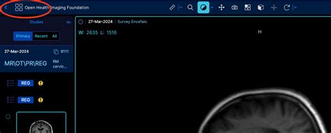 Customization Explorer And Ohif General Orthanc Users