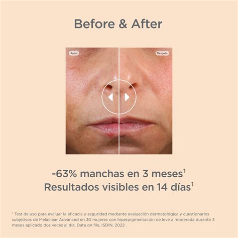 Isdinceutics Melaclear Advanced Isdin