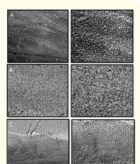 Sem Micrographs Showing Smear Layer Removal In Samples Of Group I