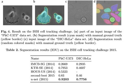 U Net Convolutional Networks For Biomedical Image Segmentation Summarized GK ADUSUMILLI