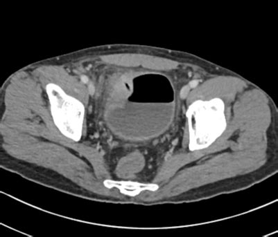 Image Radiopaedia Org