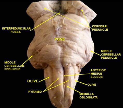 Interpeduncular Fossa