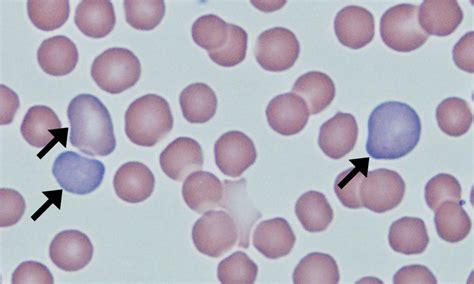 Polychromatophils Cells And Smears
