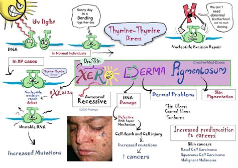 Xeroderma Pigmentosum Suit