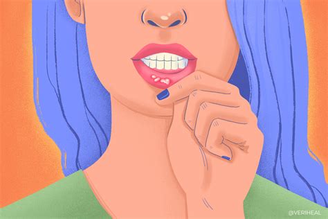 Weed Smoking Lips With Braces