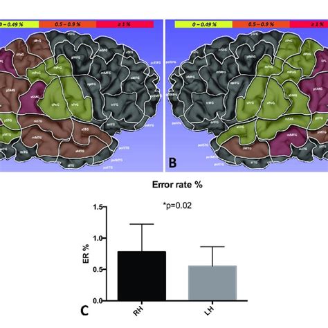 Visuospatial Outcome At One Month From Surgery Significant Reduction