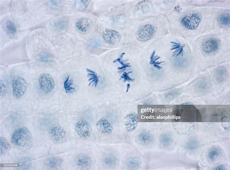 Microscope Image Of Metaphase And Anaphase In Plant Cells Stockfoto