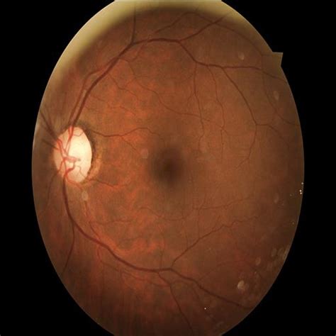 Python 3x Remove A Particular Pixel Value From Image Stack Overflow