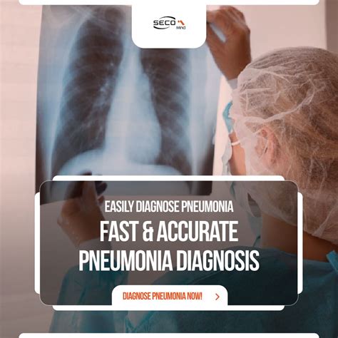 Secomind Ai On Linkedin Healthcare Deeplearning Computervision