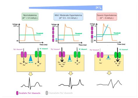 Diseases Free Full Text Hyperkalemia In Diabetes Mellitus Setting