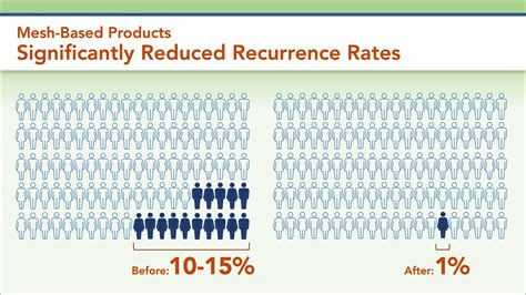 Complex Mapping Ims Legal Strategies