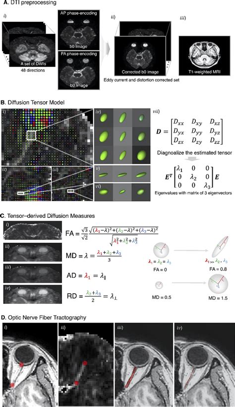 overview of diffusion tensor imaging dwi analysis a preprocessing