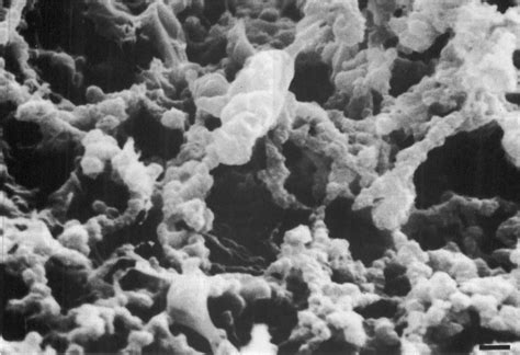 Scanning Electron Micrograph Showing A Close Up View Of The Download Scientific Diagram