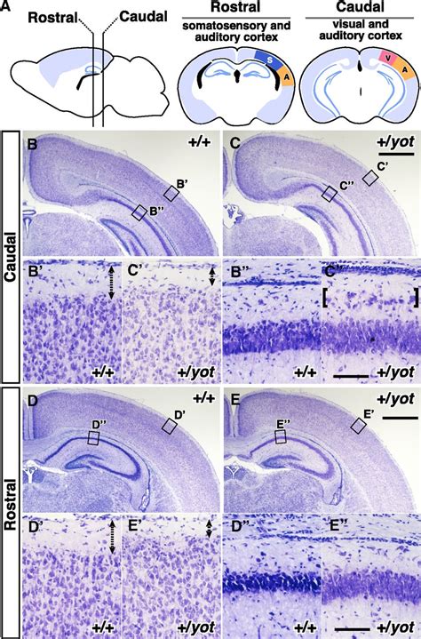 Somatosensory Cortex Mouse