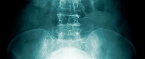 Urodynamic Testing What To Expect Advanced Urology