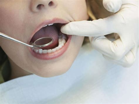 Sore Tongue Causes Of A Sore Tongue