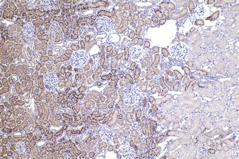 RUNX antibody AP Proteintech 武汉三鹰生物技术有限公司