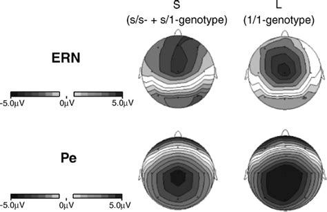 Scalp Topographic Voltage Maps Showing The Topography At The Peak Of