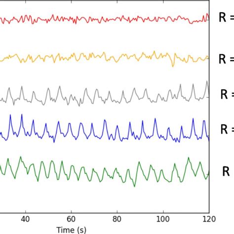 Example Waveforms Showing The First 120 S Out Of 240 S Of Data For Download Scientific