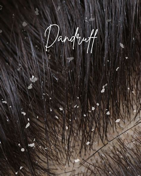 Did You Really Know Your Scalp Type The Olive Tree