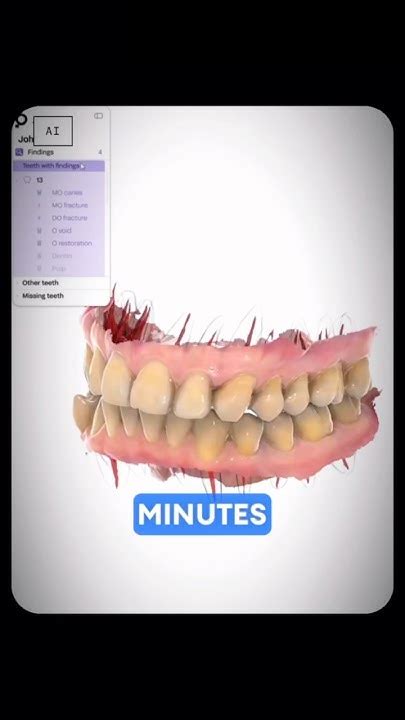 Dentist Dental Cosmeticdentist Cosmeticdentistry Implantologia Dentalhealth Robotdentist