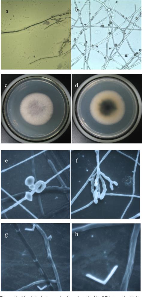 Figure 1 From Isolation And Identification Of Oleaginous Endophytic Fungi Semantic Scholar
