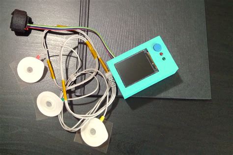 GitHub Im Abed ECG Project Portable ECG Monitoring Project Using Arduino Nano